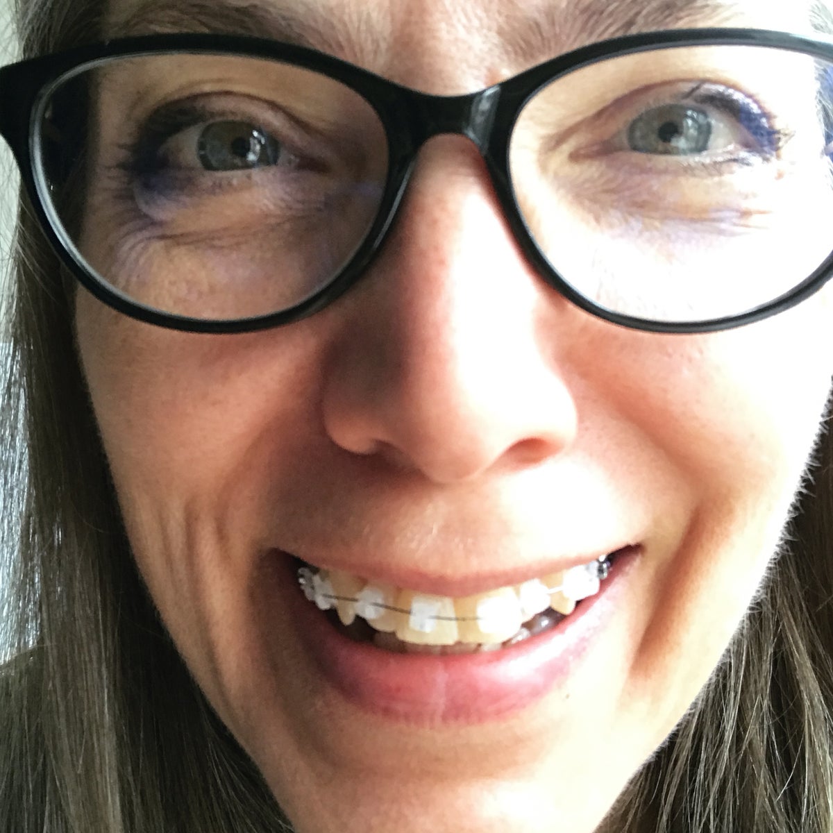 so this happened today | MLTSHP