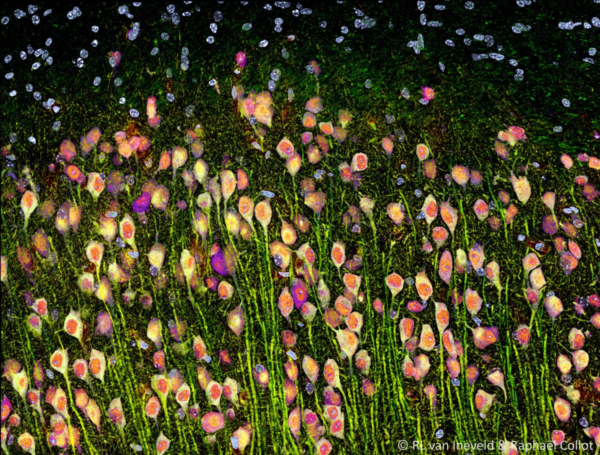 neurons looking like spring flowers | MLTSHP