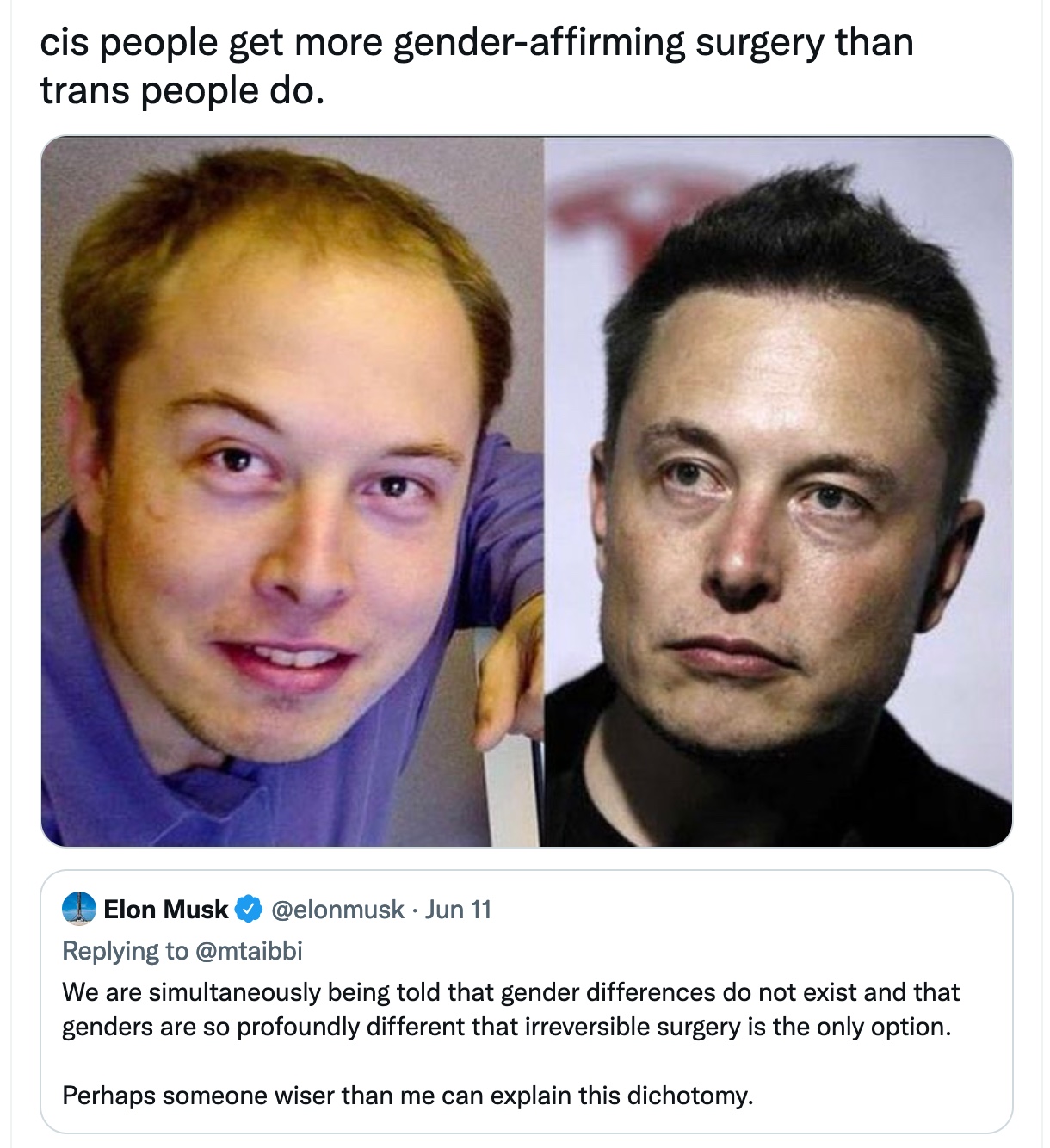 facial masculinization surgery | MLTSHP