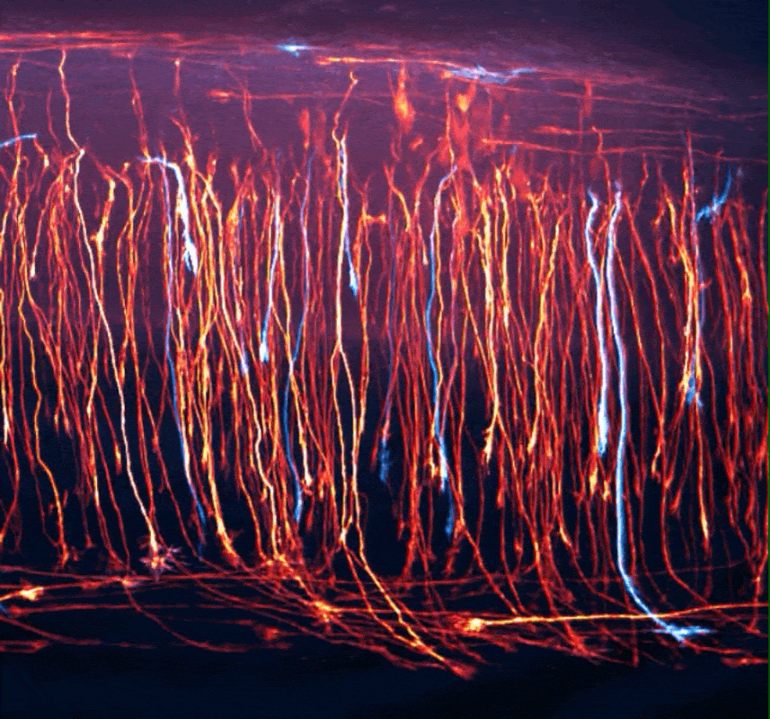 Neurons Forming Inside a Chick Embryo | MLTSHP