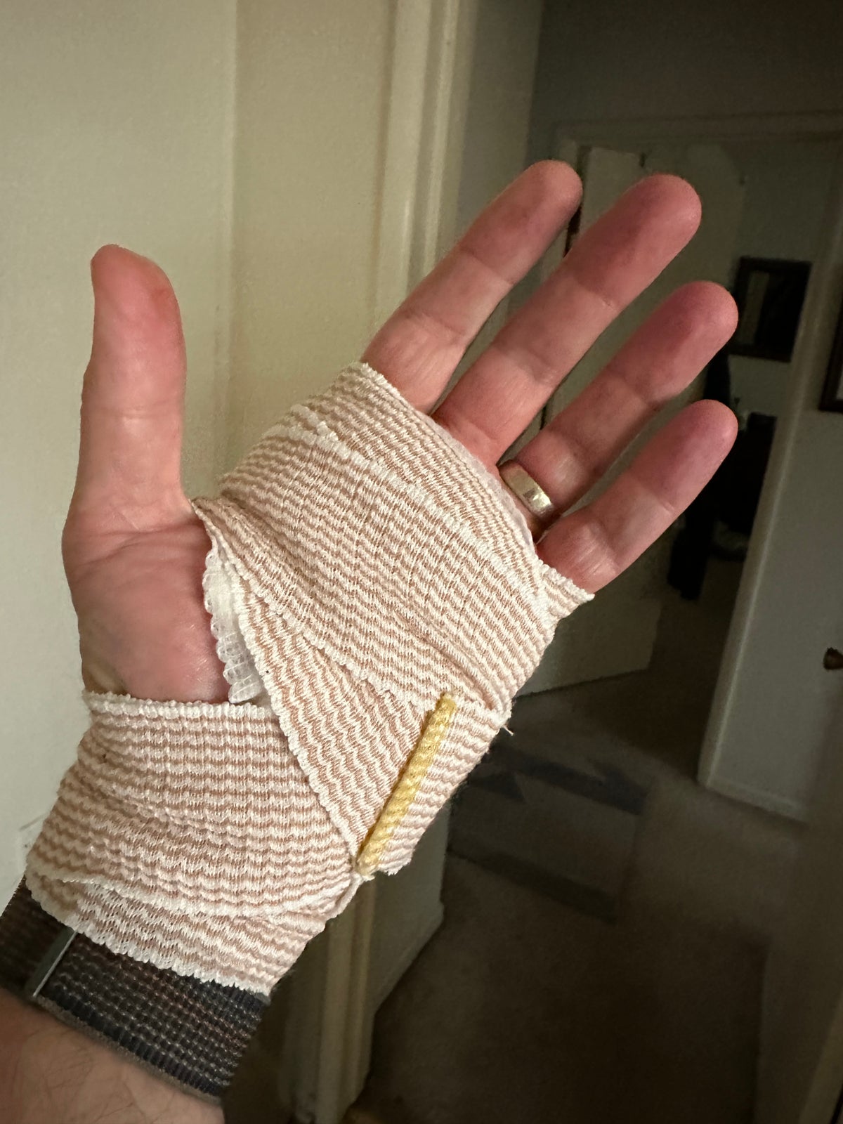 Free advice: If you drop a glass in the sink, resist the urge to "catch" it. | MLTSHP