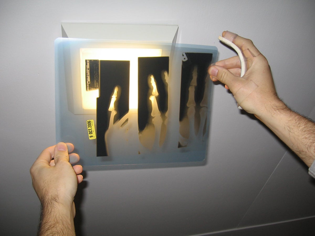 I'm late to the party, per usual. | MLTSHP